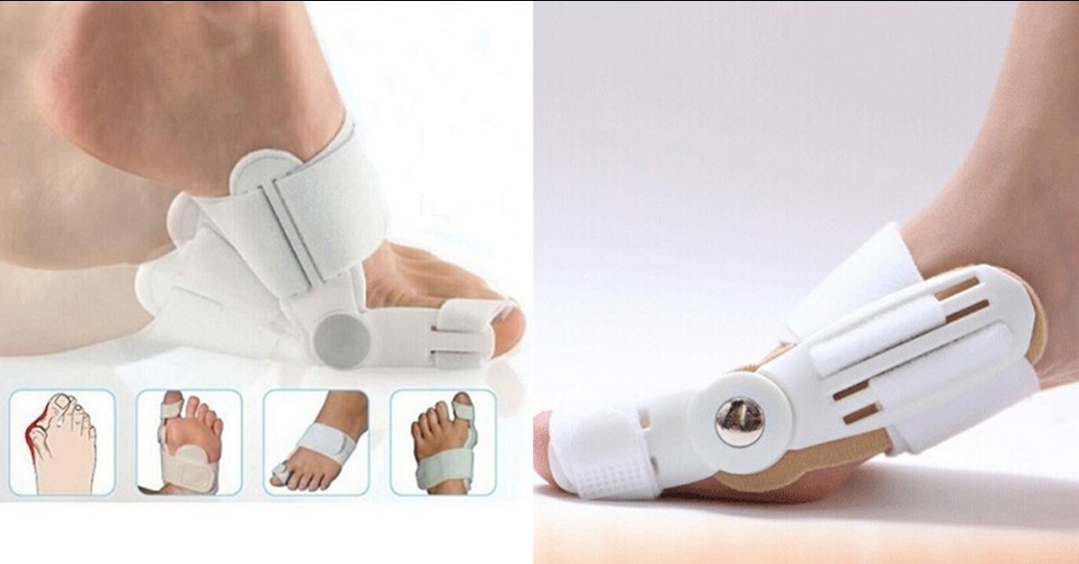 Bunion Day/Night Splint